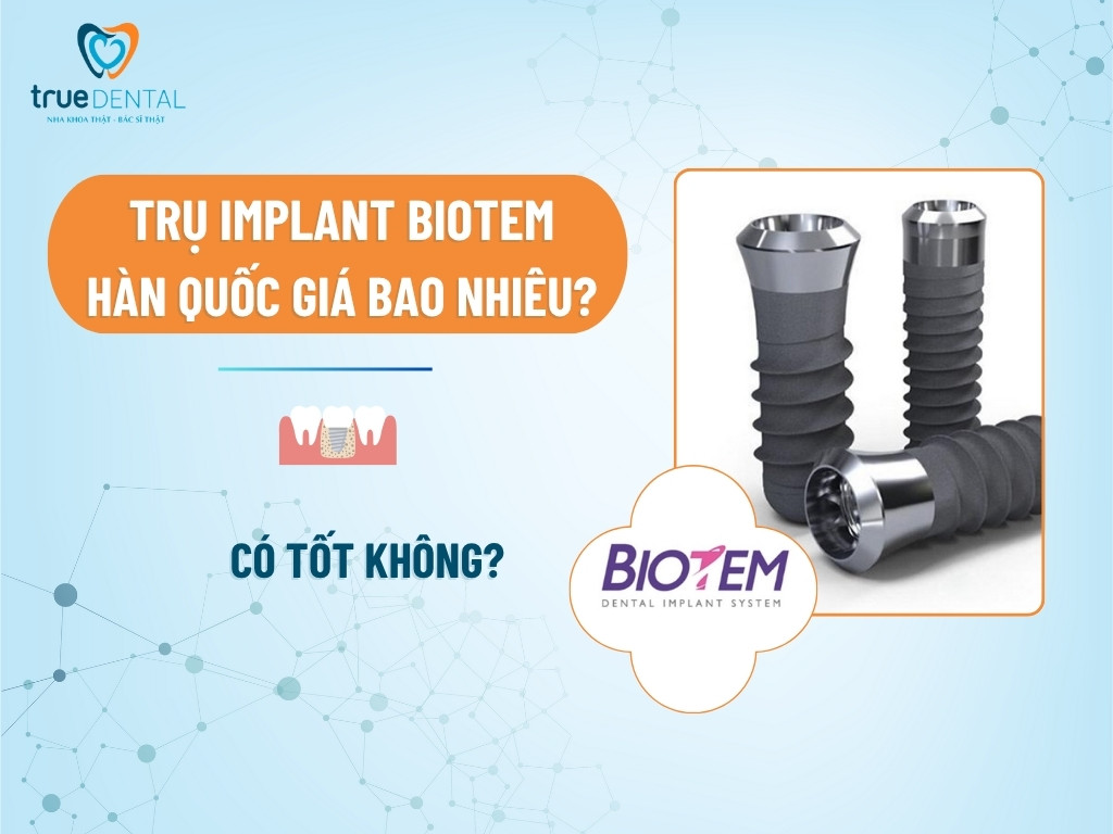 Trụ implant Biotem Hàn Quốc giá bao nhiêu? Có tốt không? - True Dental ...
