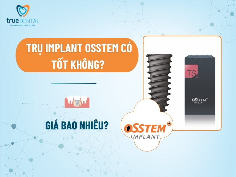 Trụ Implant Osstem có tốt không? Giá bao nhiêu? - True Dental - Nha ...