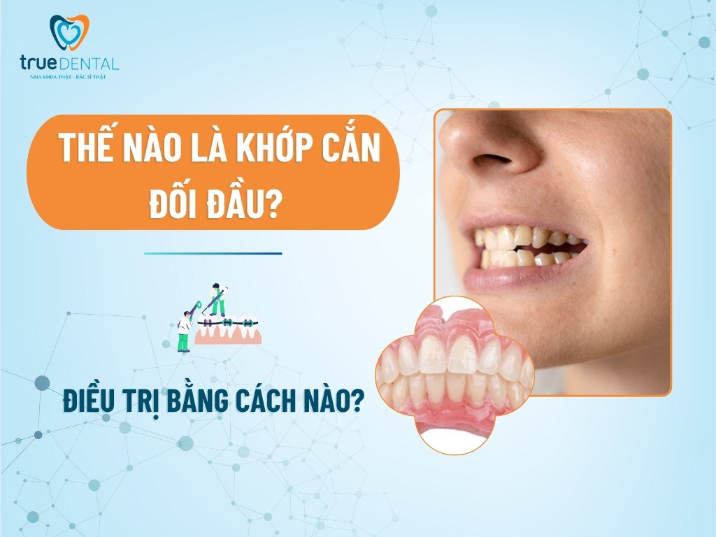 Thế nào là khớp cắn đối đầu? Điều trị bằng cách nào? - True Dental ...